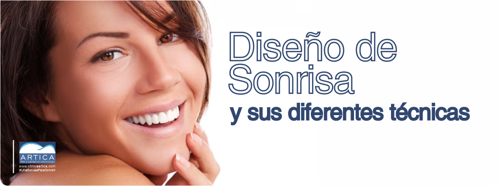 Diseño de sonrisa y técnicas odontológicas - Clínica Ártica